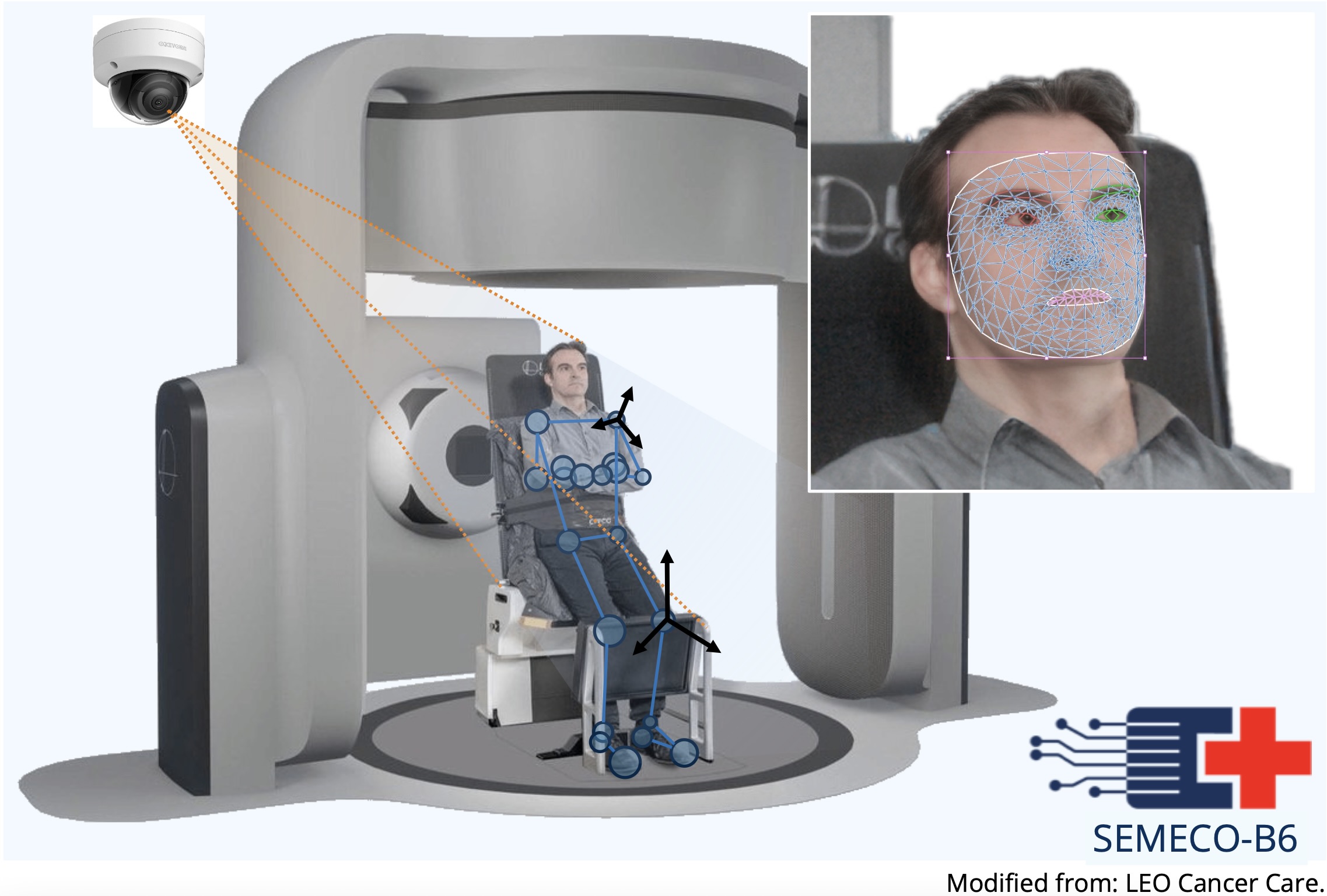 Intelligent patient positioning in precision radiotherapy - SEMECO